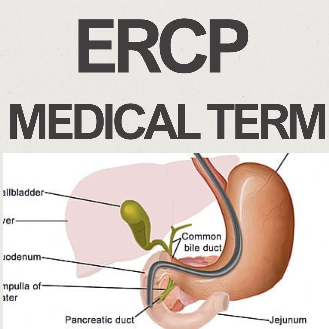 ERCP Medical Abbreviation - Analgesia