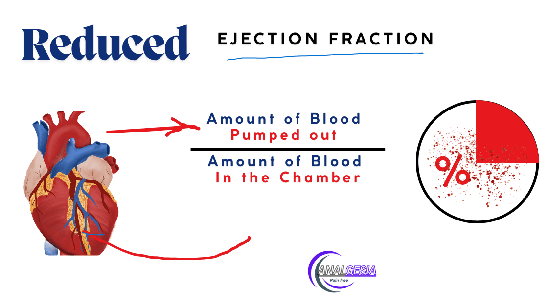 HFREF Medical Abbreviation - Analgesia