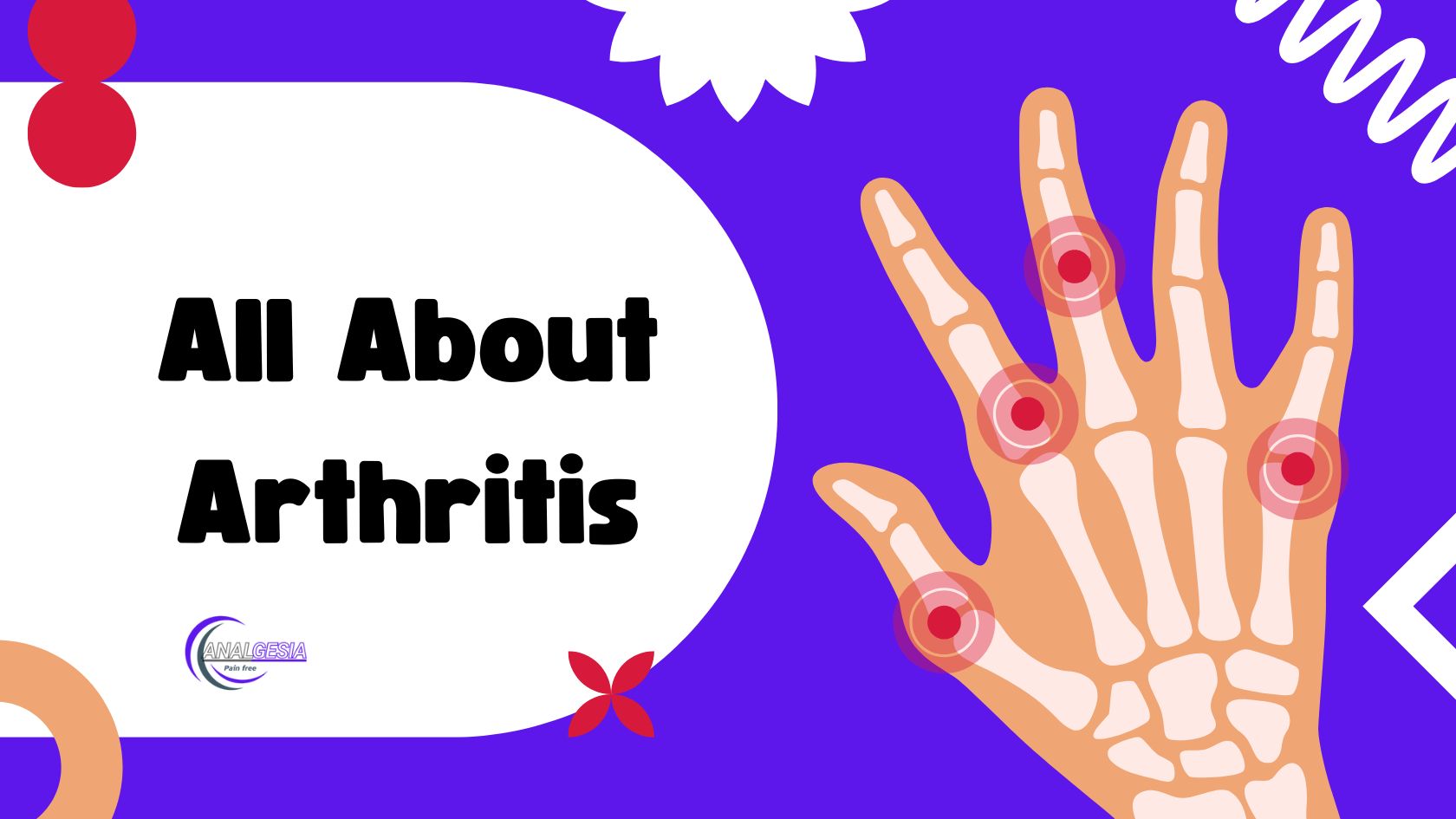 Arthritis Pain (Overview) - Analgesia