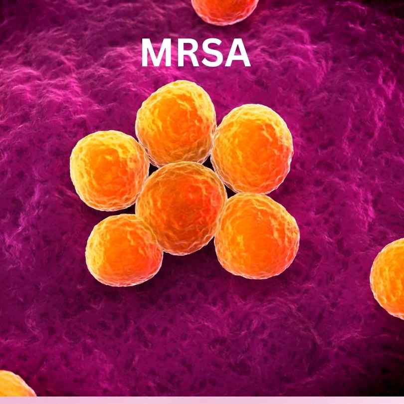 MRSA Medical Abbreviation - Analgesia