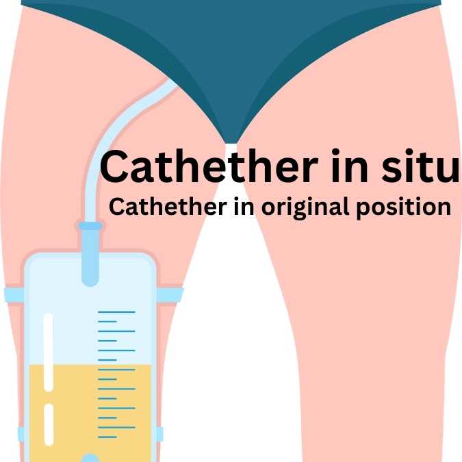 In Situ in Medical: What It Means and How It’s Used in Diagnosis ...