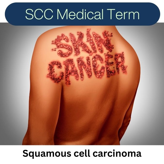 SCC Medical Abbreviation - Analgesia
