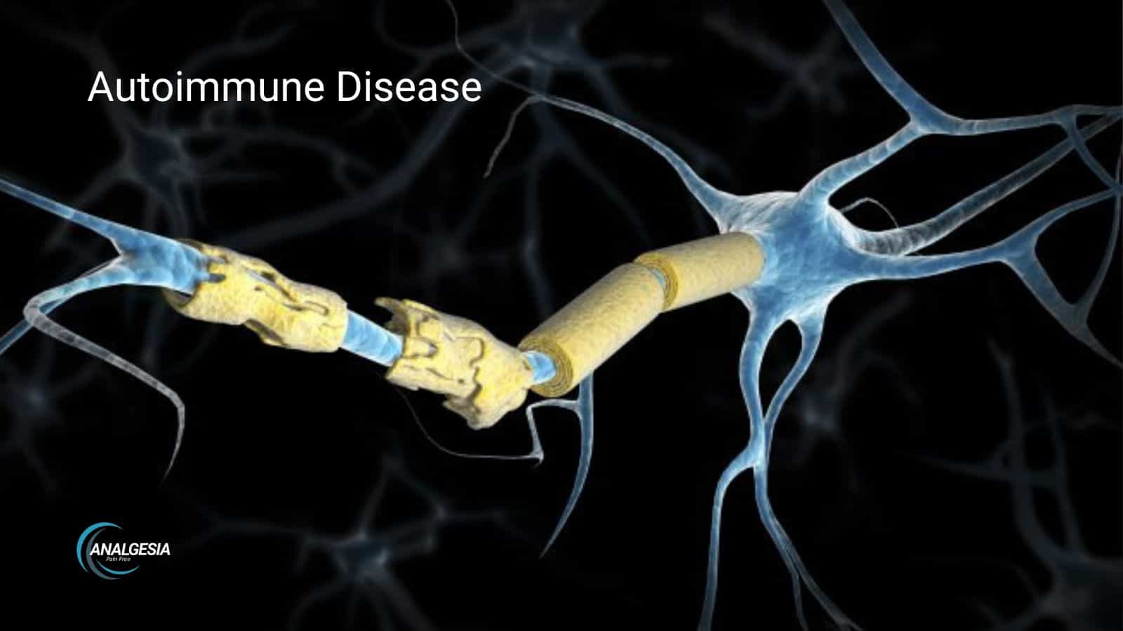 Autoimmune Disease Meaning - Analgesia