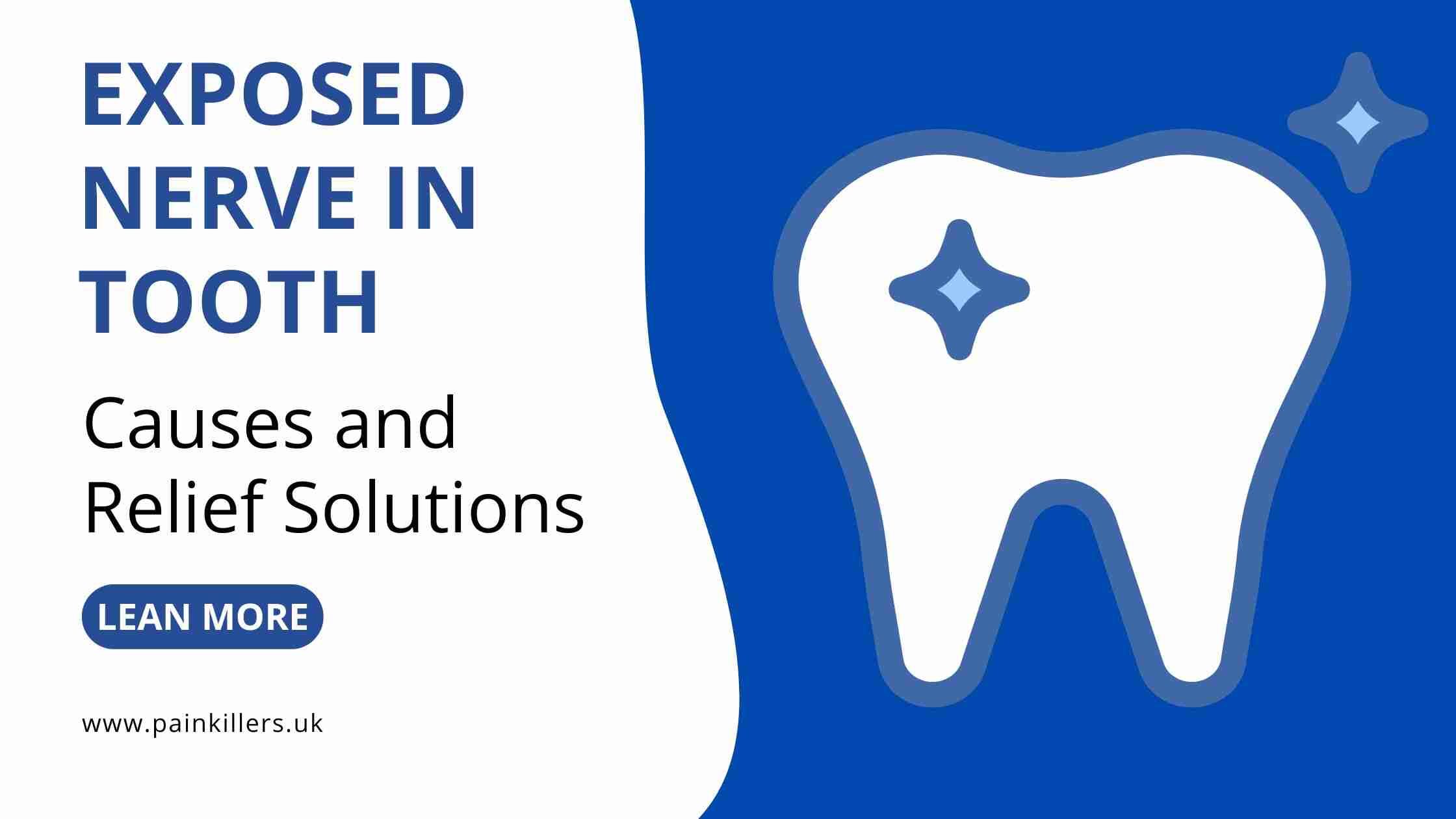 Exposed Nerve in Tooth: Causes, Symptoms & Relief Solutions