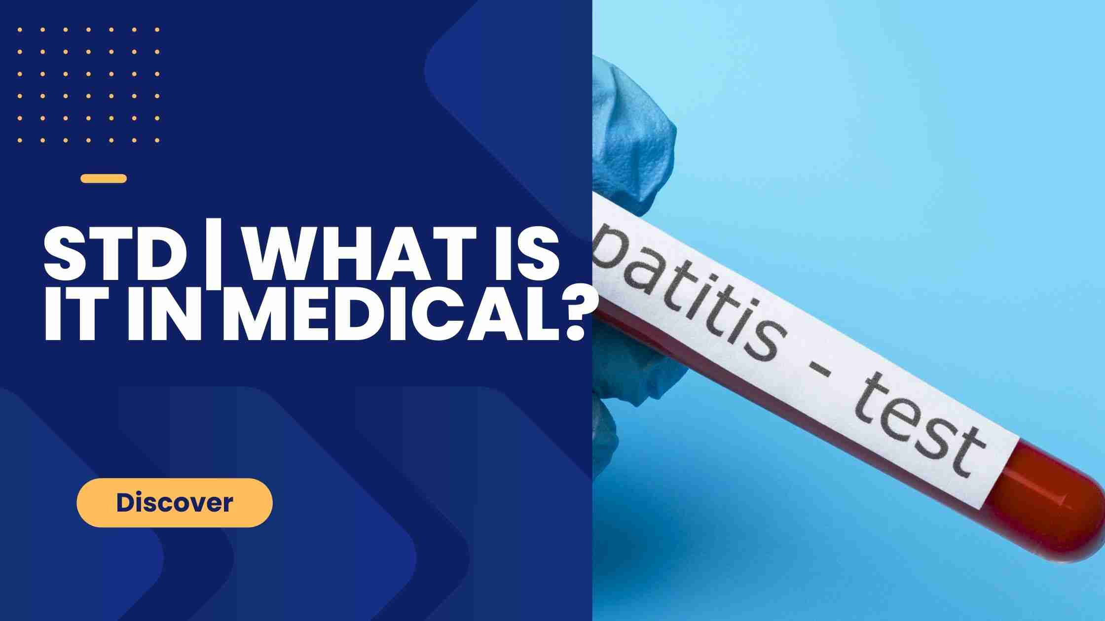 STD—what is it in medical? - Analgesia